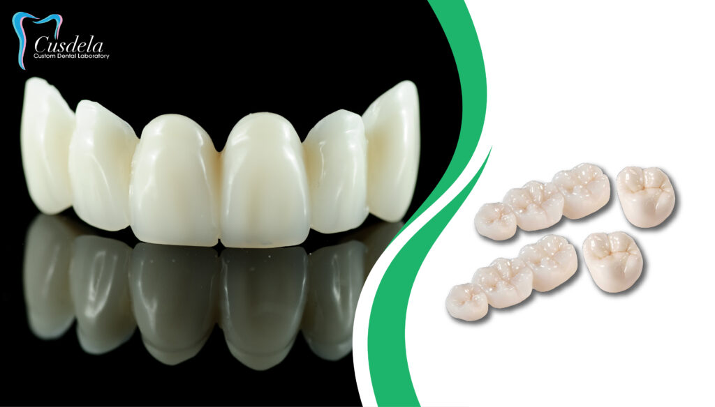Layered Vs Solid Zirconia: Everything you need to know. | Blog